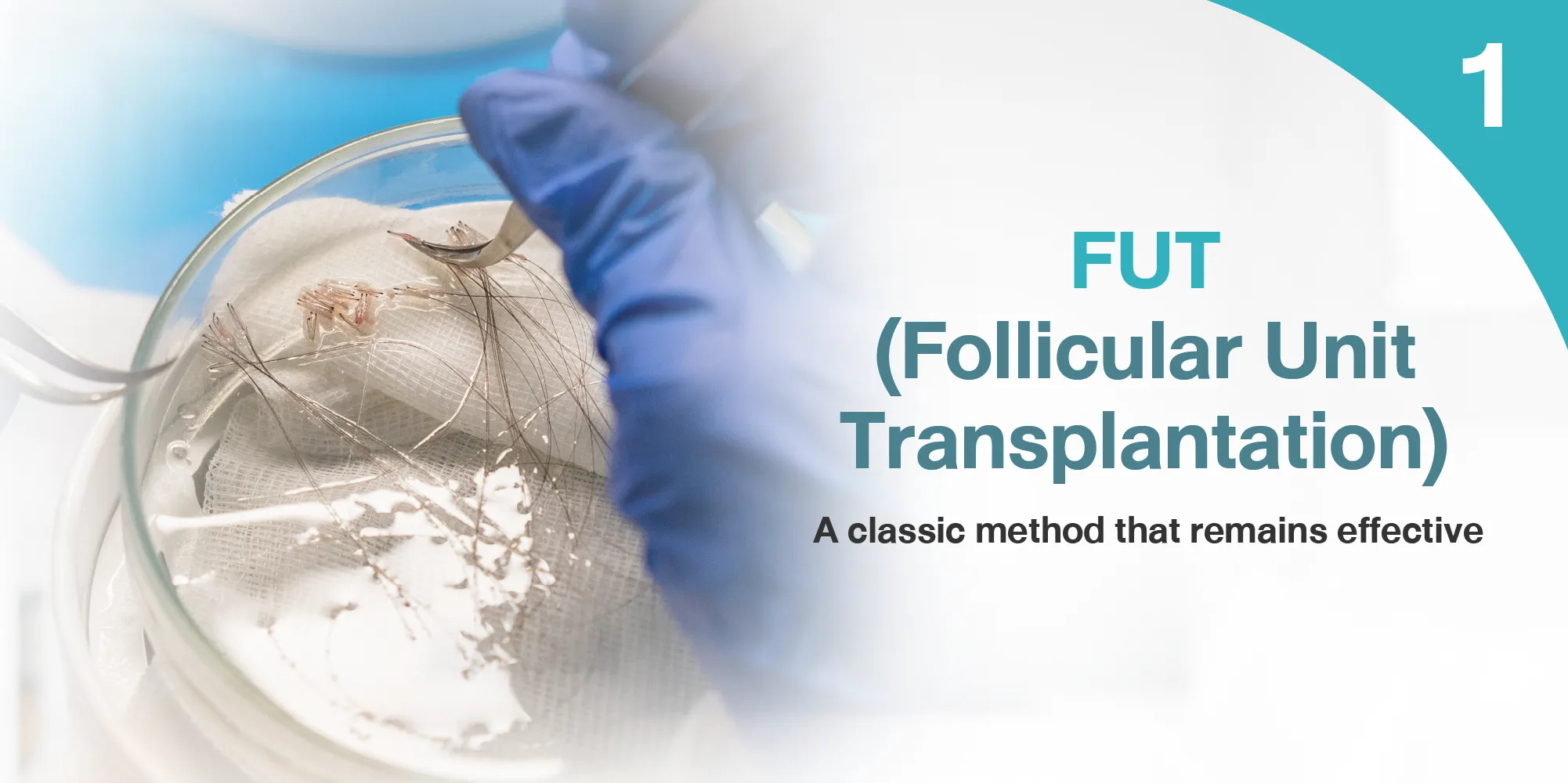 Top Hair Transplant Techniques in 2025: What’s Worth Considering? - DHI ...